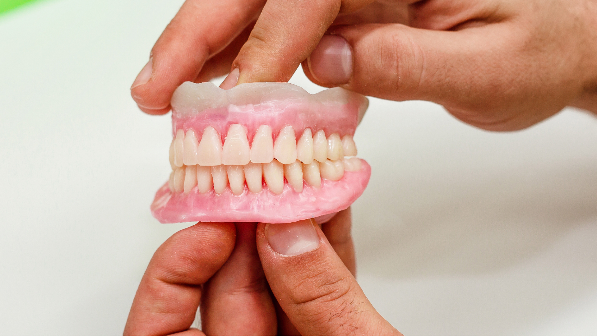 Removable Prosthesis - De Sá Moreira Clinic - Clínica Dentária