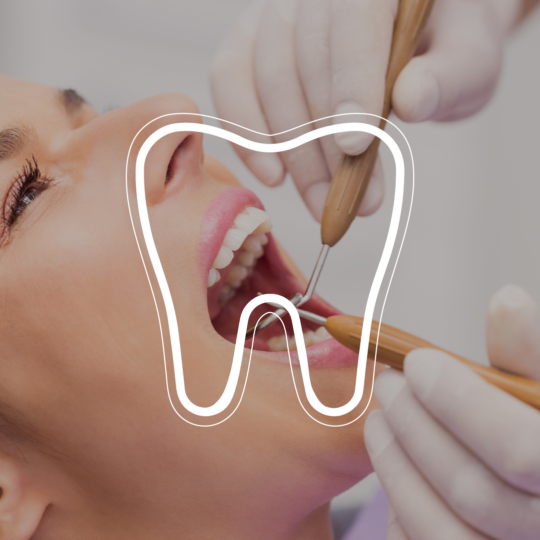 Medicina Dentária Preventiva - De Sá Moreira Clinic - Dentista